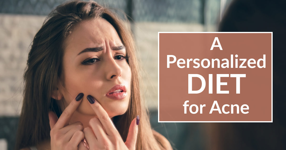 Your Personalized Anti Acne Diet for Clear & Glowing Skin [from Within]